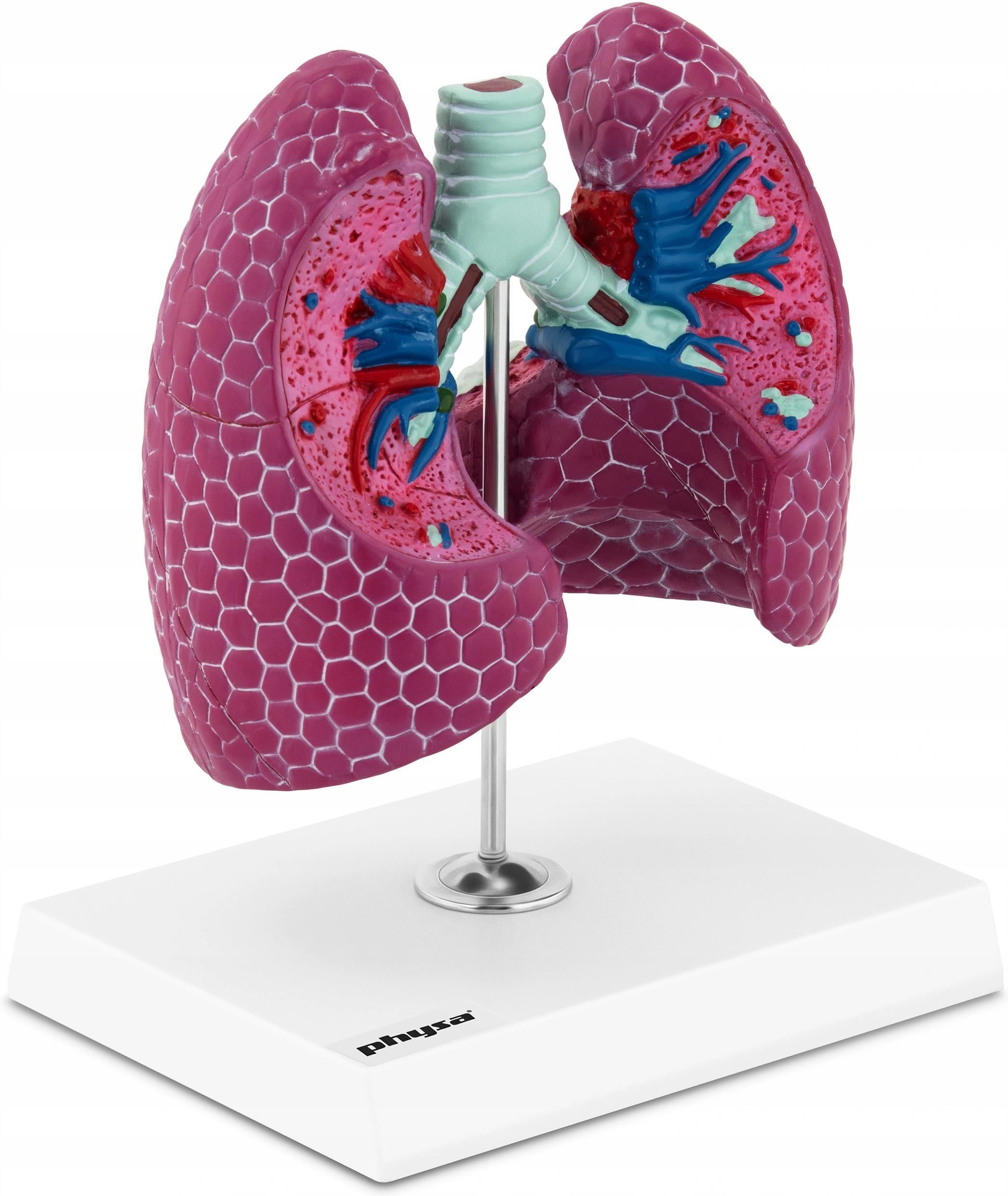 Physa Model 3D Anatomiczny Chorych Płuc Phy-Lm-1 - Ceny i opinie - Ceneo.pl