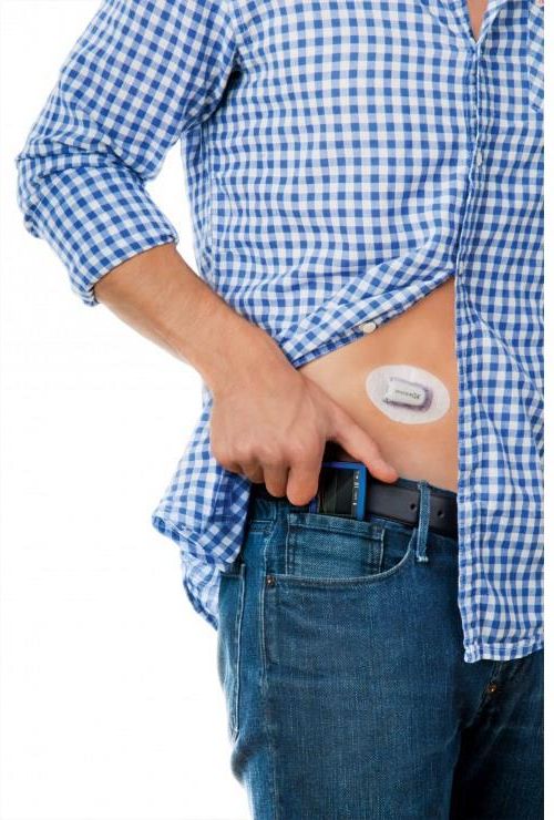 Dexcom Inc Sensor CGM-RT G4 PLATINUM/G5 Mobile, 1 szt. - Opinie i ceny ...