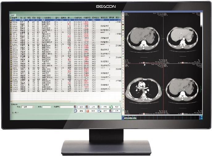 Monitor Beacon Display (C25W) - Opinie i ceny na Ceneo.pl