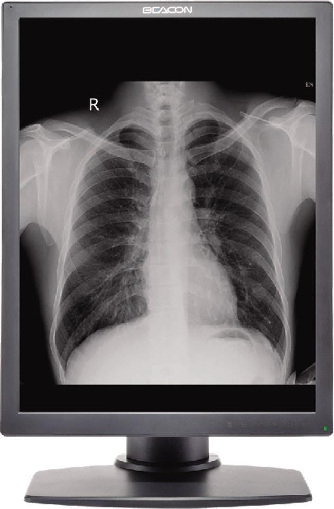 Monitor Beacon Display (G22S+) - Opinie i ceny na Ceneo.pl
