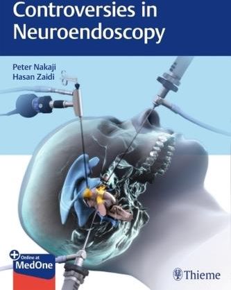 Controversies in Neuroendoscopy Belykh, Evgenii; Martirosyan, Nikolay L ...