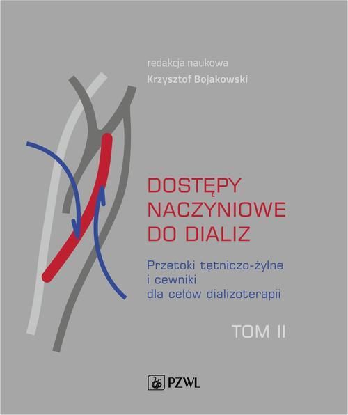 Dostępy naczyniowe do dializ. Tom 2 (EPUB) - Ceny i opinie - Ceneo.pl