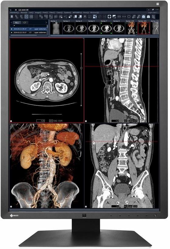 Monitor EIZO RadiForce 21,3 (RX250 BK) - Opinie i ceny na Ceneo.pl