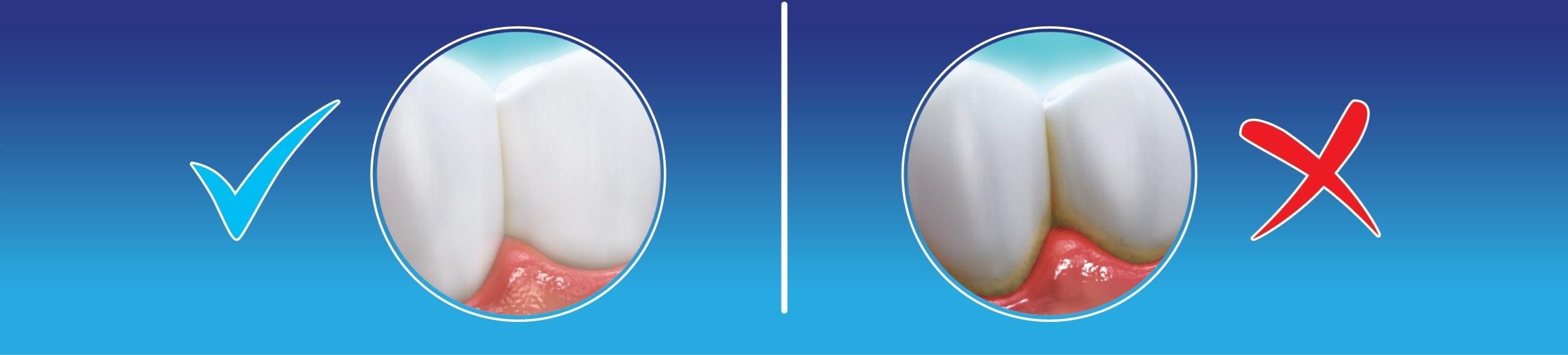 Meridol Complete Care Sensitive Gums & Teets miękka 1szt - Opinie i ...