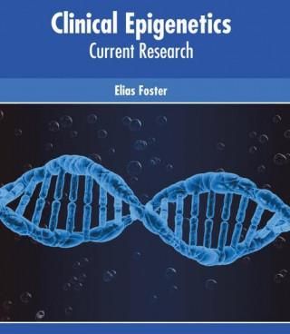 Clinical Epigenetics: Current Research - Literatura obcojęzyczna - Ceny i opinie - Ceneo.pl