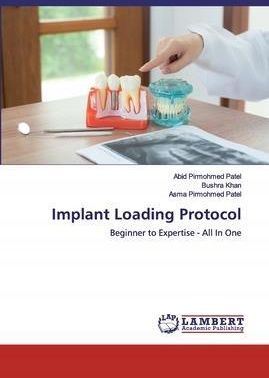Implant Loading Protocol - Literatura obcojęzyczna - Ceny i opinie ...