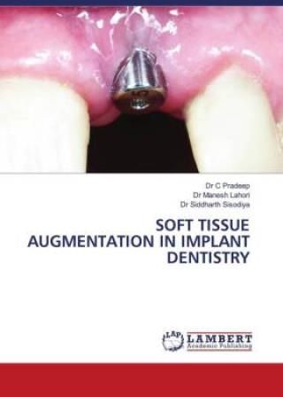 SOFT TISSUE AUGMENTATION IN IMPLANT DENTISTRY - Literatura obcojęzyczna ...