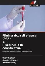 Fibrina ricca di plasma (PRF) & Il suo ruolo in odontoiatria ...