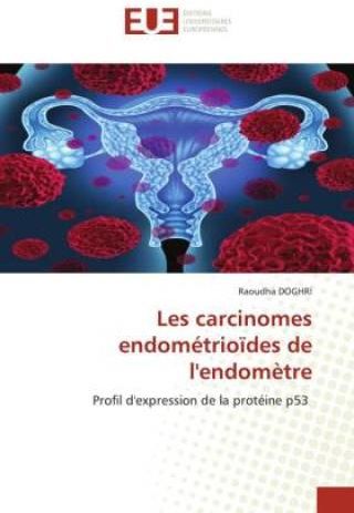 Les carcinomes endométrio?des de l'endom?tre - Literatura obcojęzyczna ...