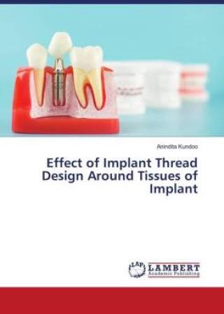 Effect of Implant Thread Design Around Tissues of Implant - Literatura ...