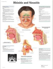 3B Scientific Anatomia Człowieka Wykres Nieżytu Nosa I Zapalenia Zatok ...