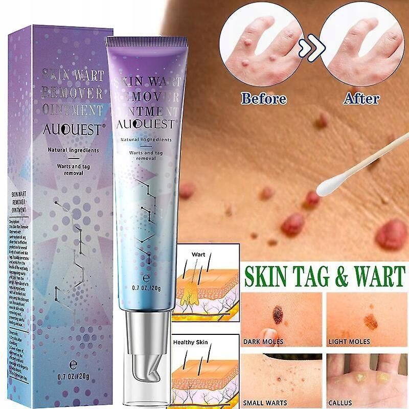 Skin Tag Warts Remove Ointment Papillomas - Ceny i opinie - Ceneo.pl