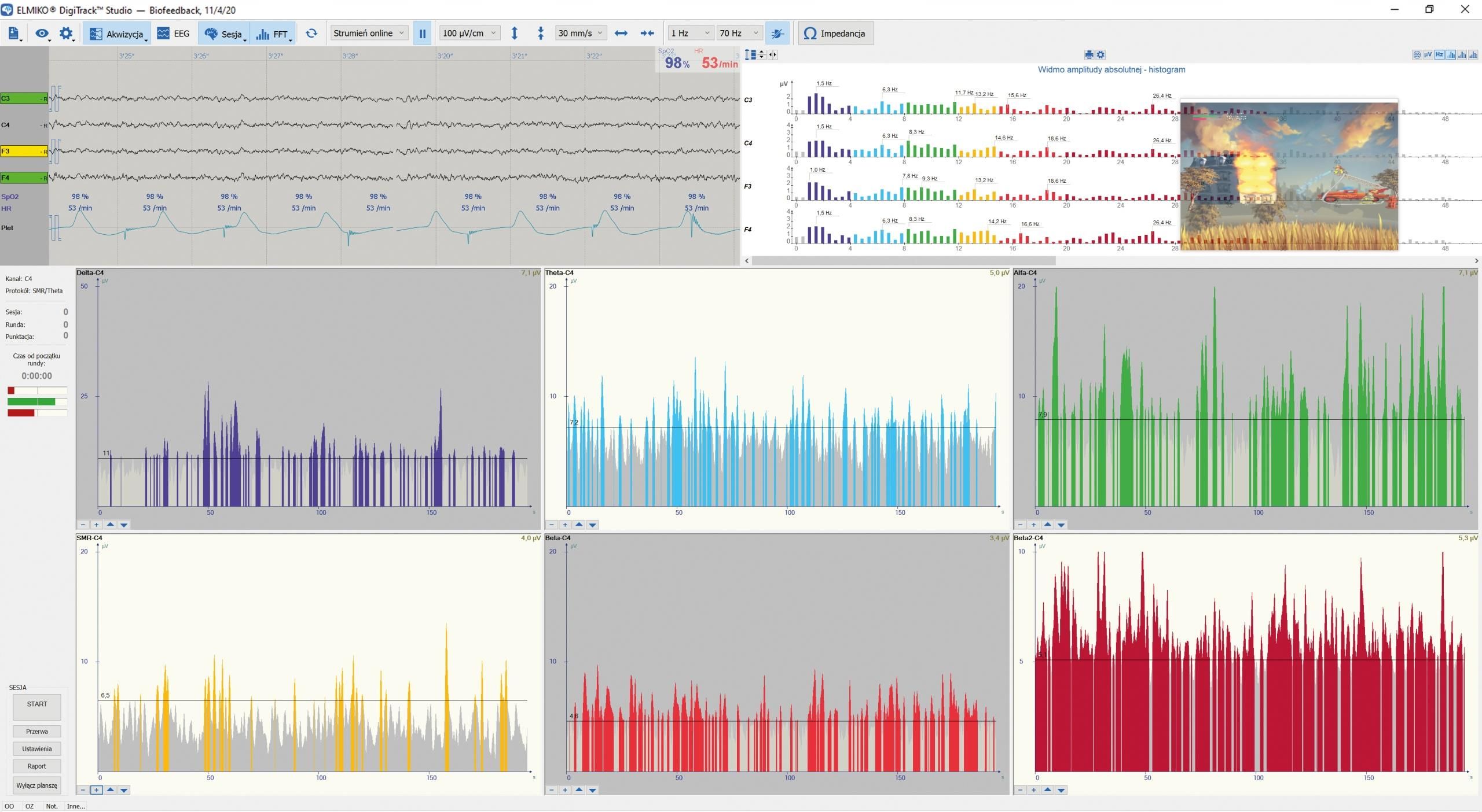 Pakiet Eeg Biofeedback Vr 2 Kanałowy Elmiko Pl - ceny i opinie - Ceneo.pl