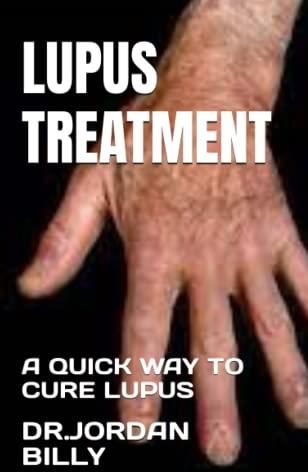 LUPUS TREATMENT: A QUICK WAY TO CURE LUPUS - Literatura obcojęzyczna ...