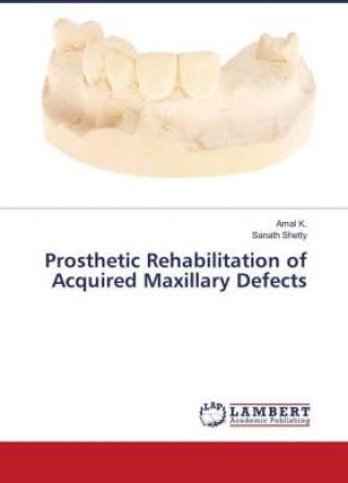 Prosthetic Rehabilitation of Acquired Maxillary Defects - Literatura ...