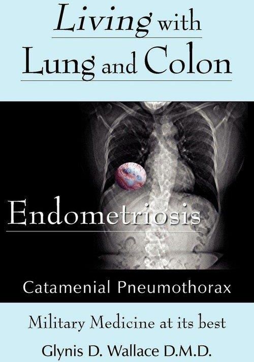 Living With Lung and Colon Endometriosis - Literatura obcojęzyczna ...