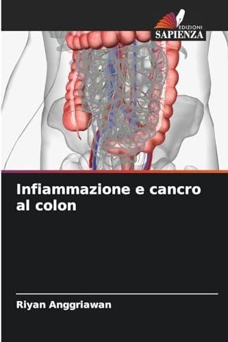 Infiammazione e cancro al colon - Literatura obcojęzyczna - Ceny i ...