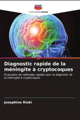 Diagnostic rapide de la méningite à cryptocoques - Literatura ...