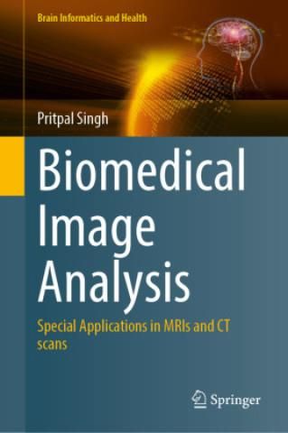 Biomedical Image Analysis - Literatura obcojęzyczna - Ceny i opinie - Ceneo.pl