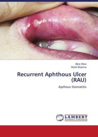 Recurrent Aphthous Ulcer (RAU) - Literatura obcojęzyczna - Ceny i opinie - Ceneo.pl