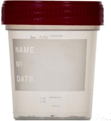 Pojemnik na mocz, niejałowy, (Promet), 100 ml - Opinie i ceny na Ceneo.pl