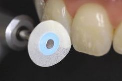 KERR HAWE Krążki OptiDisc zestaw 4x30szt./12,6 mm+ mandrylka ...