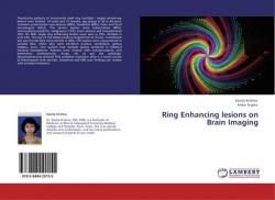 Ring Enhancing lesions on Brain Imaging - Literatura obcojęzyczna ...