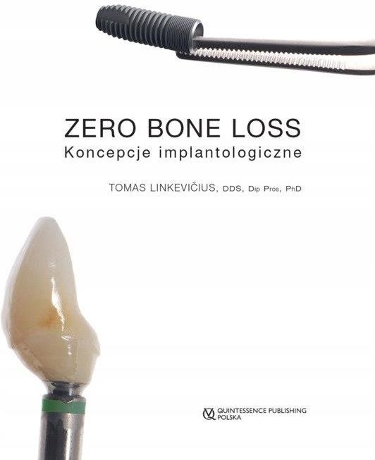 Zero Bone Loss - Koncepcje Implantologiczne - ceny i opinie - Ceneo.pl