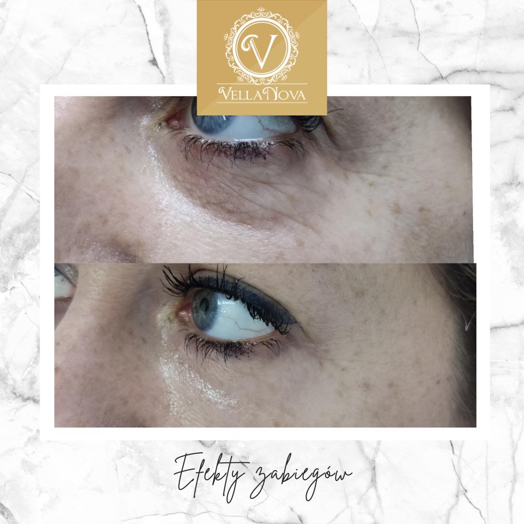 Twac Eyes 1Ml - Ceny i opinie - Ceneo.pl